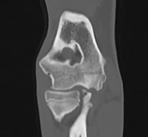 Orthopaedic service - Fitzpatrick Referrals