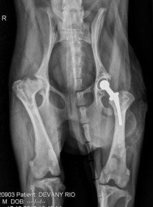 Total hip replacement - Fitzpatrick Referrals