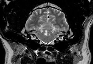 Vestibular disease - Fitzpatrick Referrals