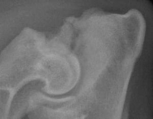 Elbow Ununited Anconeal Process (UAP) - Fitzpatrick Referrals