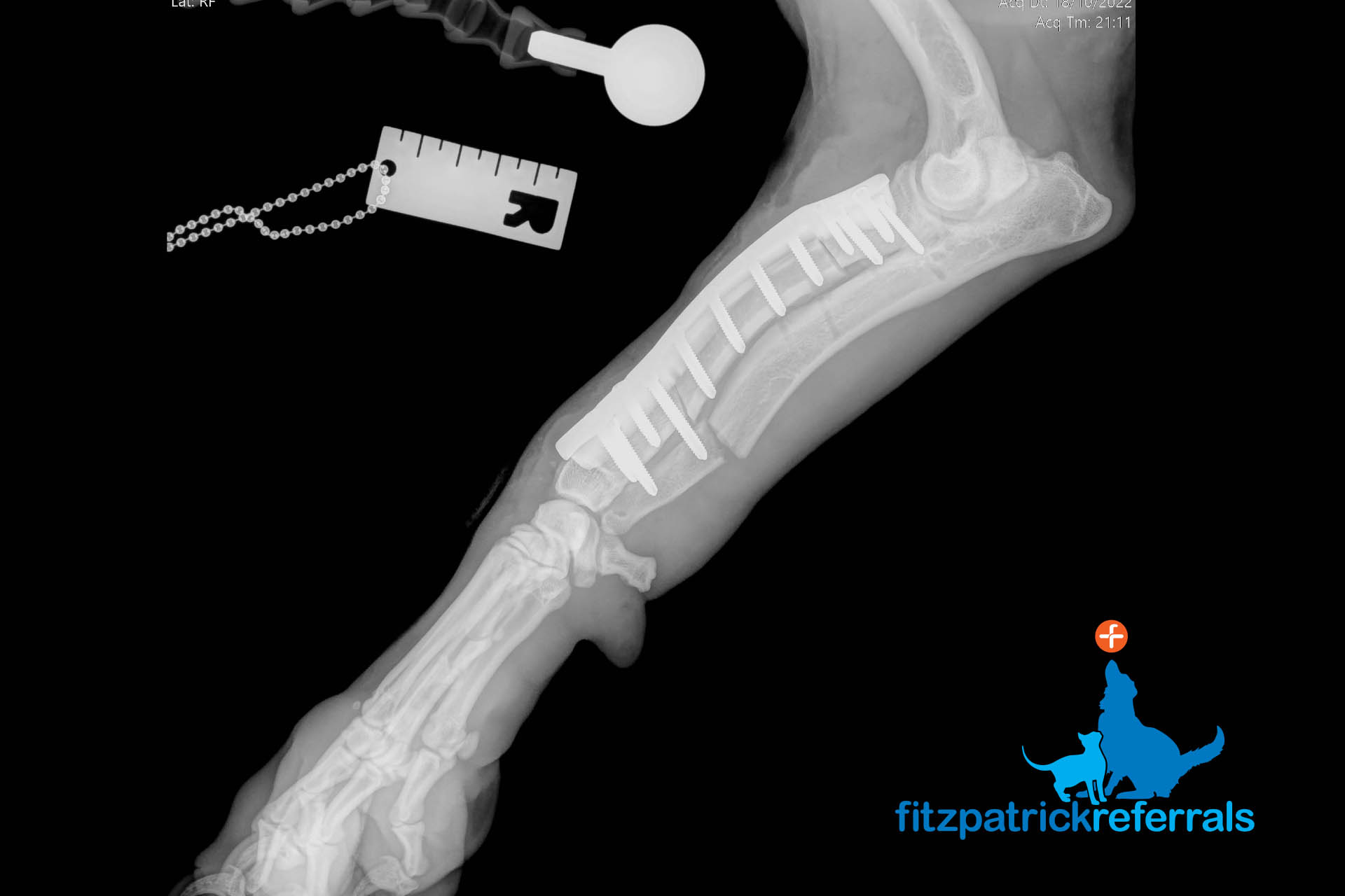 Monty's bilateral antebrachial growth deformity - Fitzpatrick Referrals