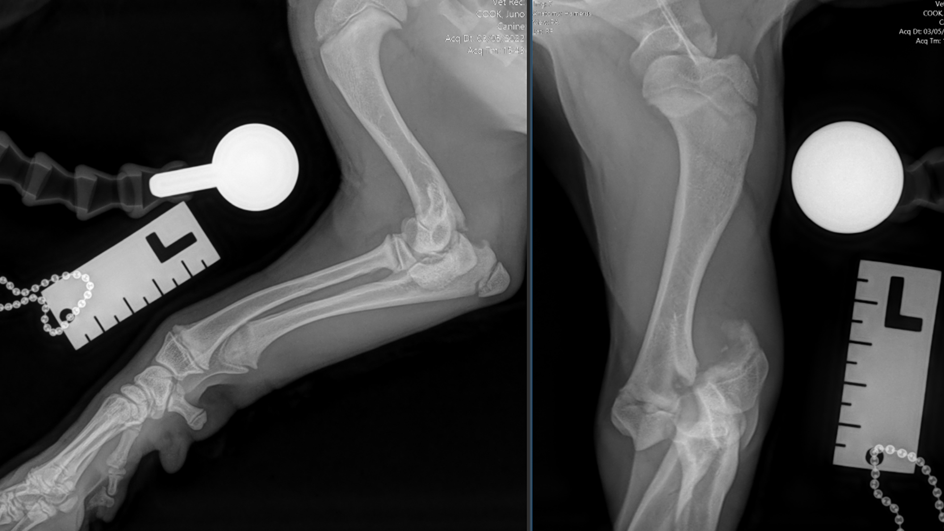 Juno's humeral condylar fracture - Fitzpatrick Referrals