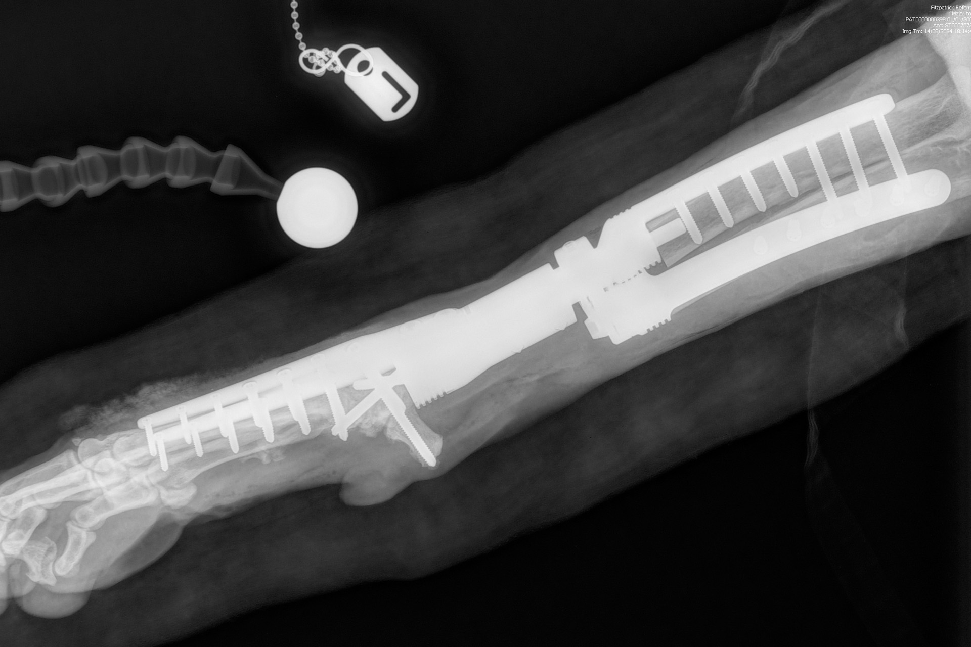 Major Tom's osteosarcoma - Fitzpatrick Referrals